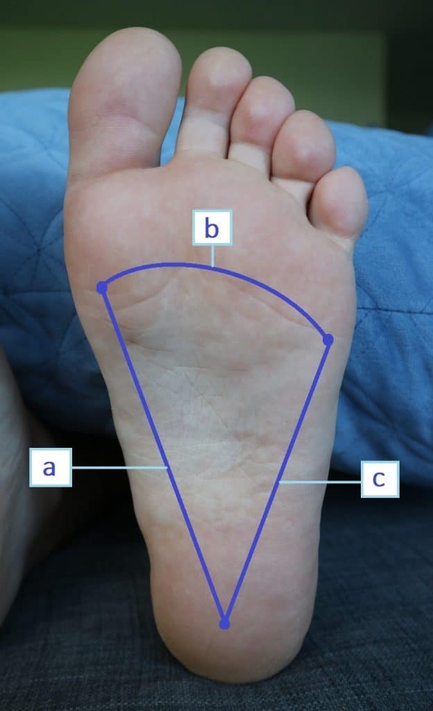Why Orthotics are the Best - Foot, Ankle & Body Experts Health Clinic